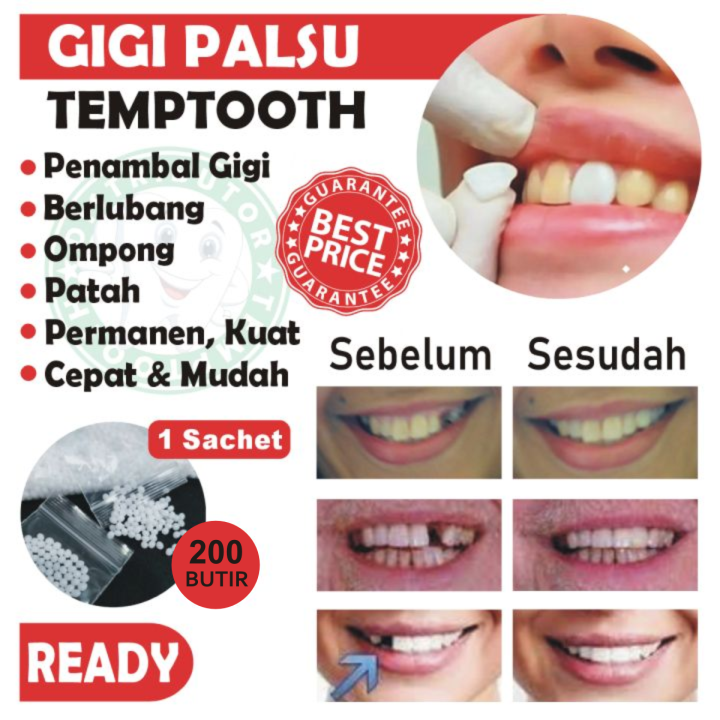 isi 200 butir penambal gigi temptooth tambal gigi | Lazada Indonesia