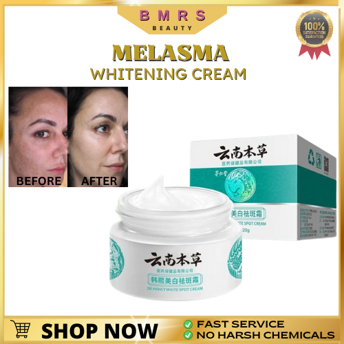 Japanese Melasma Cream Whitening Cream For Face Remove Dark Spots ...