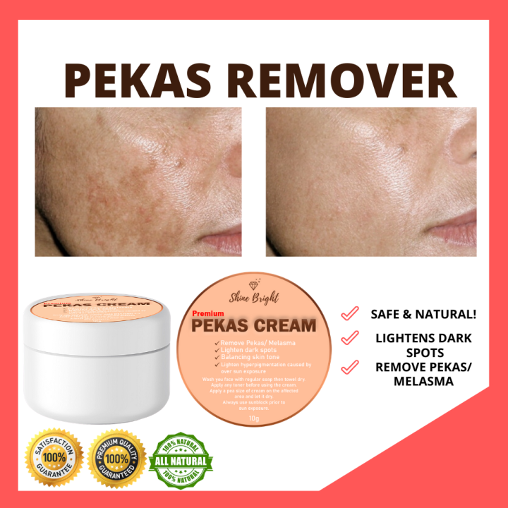 melasma and dark spot remover pekas remover cream original (melasma ...
