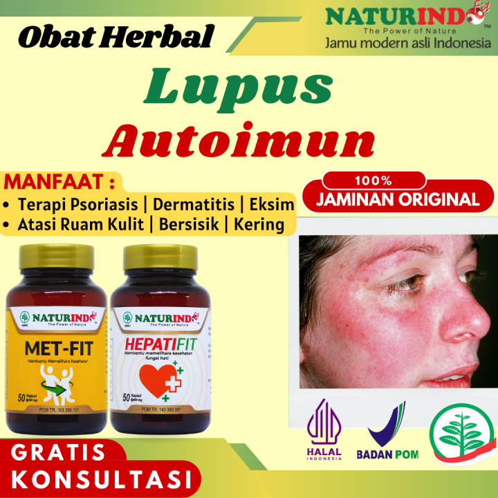 Obat Herbal Autoimun Lupus Psoriasis Eksim Dermatitis Kulit Ruam ...