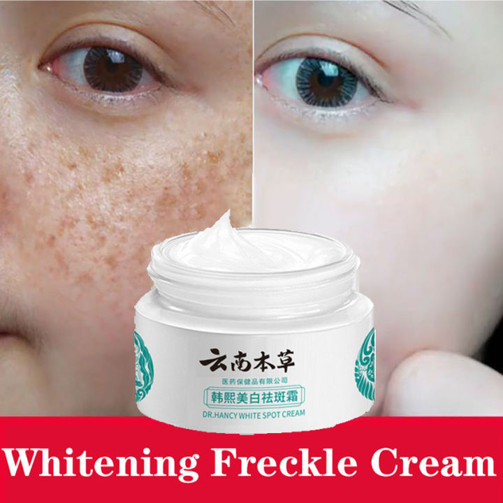 30g Dark Spot Corrector Cream Powerful Whitening Freckle Melasma Melanin Fade Pigmentation ...