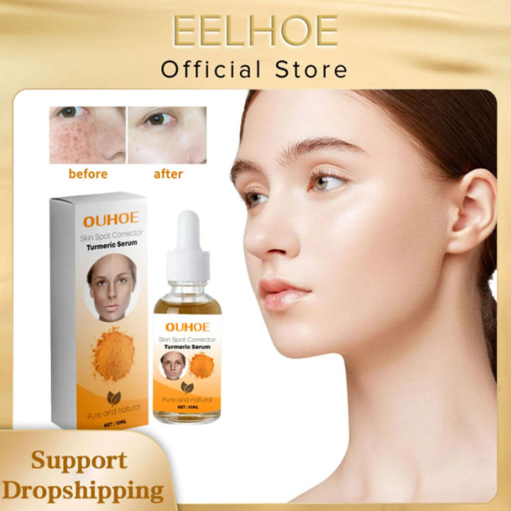 Turmeric Freckle Whitening Serum Melanin Correcting Lighten Ac-ne Dark Patches Fade Pigment ...