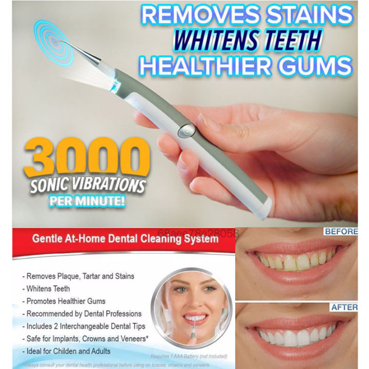 Electric Ultrasonic Tooth Stain Plaque Remover Tool Teeth Whitening ...