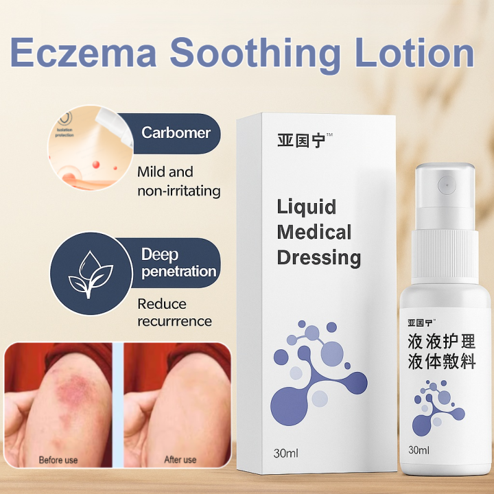 Eczema Relieving Itch Spray Skin Care Liquid Dressing Urticaria ...
