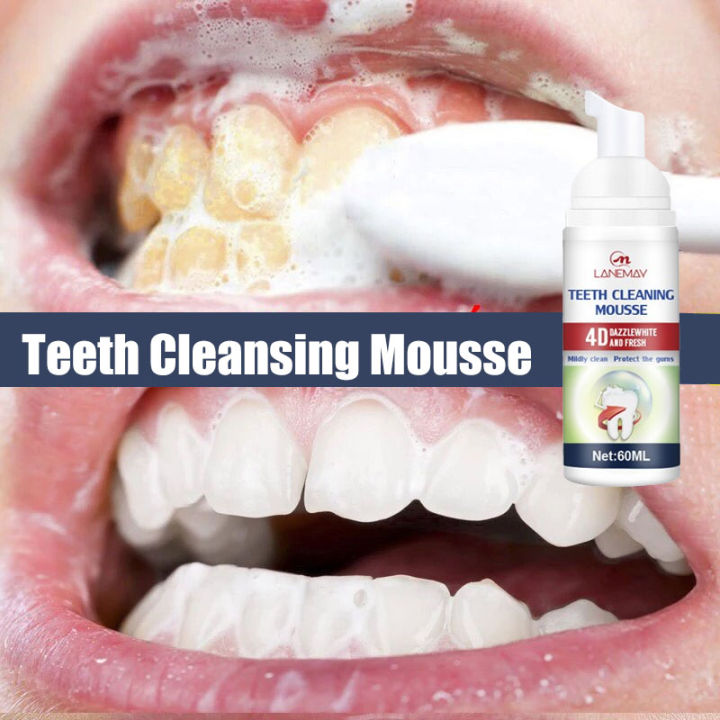 Teeth Whitening Mousse Toothpaste Cleansing Teeth Mousse Remove Plaque ...