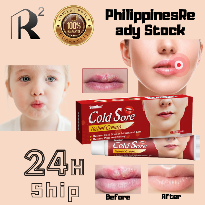 20g Cold Sores Lip Care Cream Repair Cheilitis Lips Herpes Ulceration Antibacterial Ointment ...