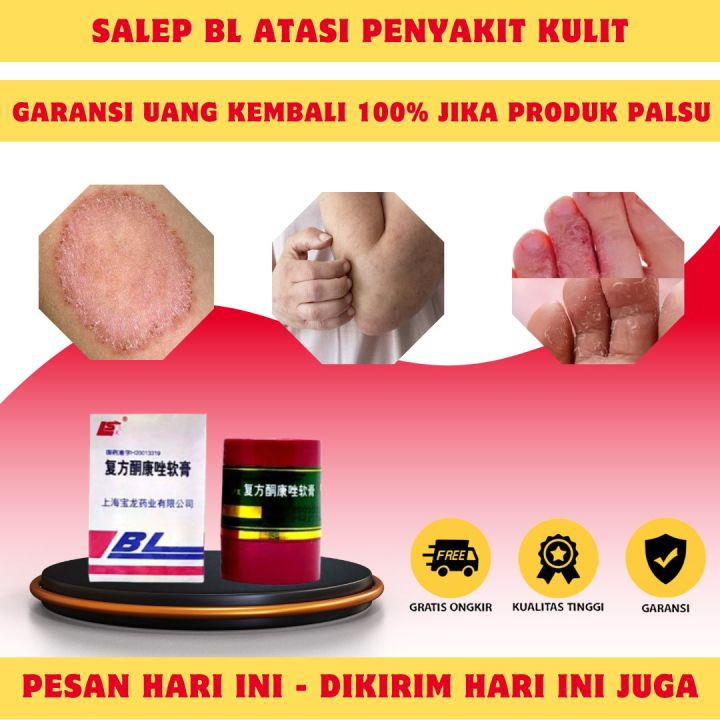 Salep Bl Original 100 Asli Untuk Gatal | Lazada Indonesia