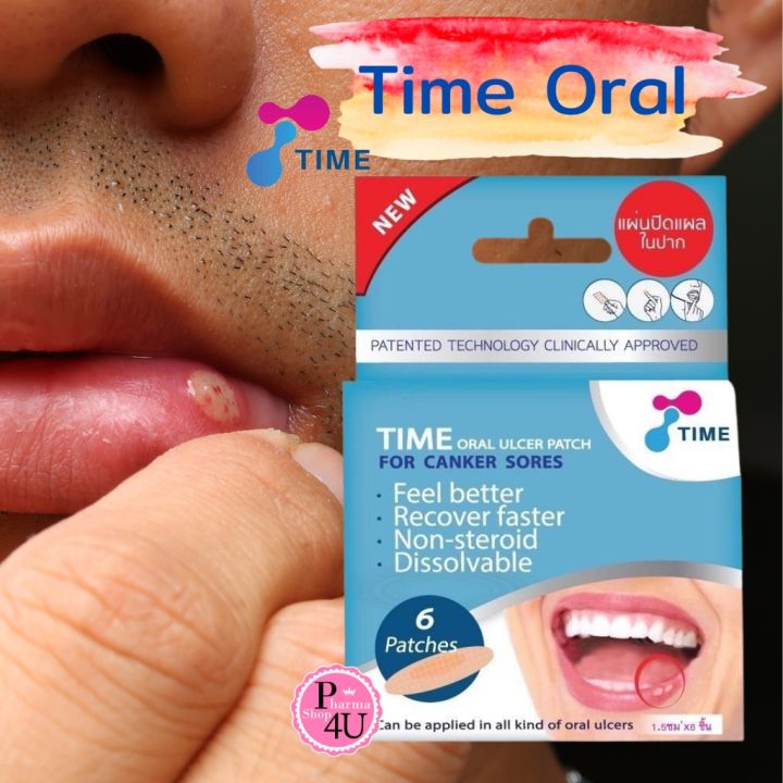 Time Oral Ulcer Patch 1 Pcs Mouth Ulcers Patch Hot Wound Patch | Lazada PH