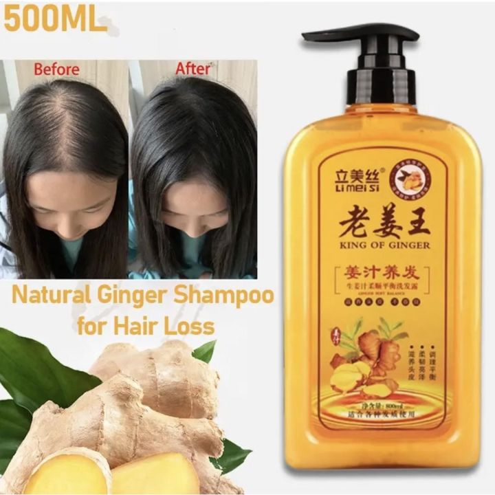 Zx Homes Ginger Hair Shampoo Fast Regrowth Thick Anti Hair Loss Anti