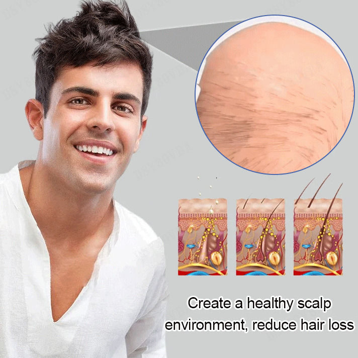 Hair Growth Formula for Stronger and Healthier Hair dense | Lazada