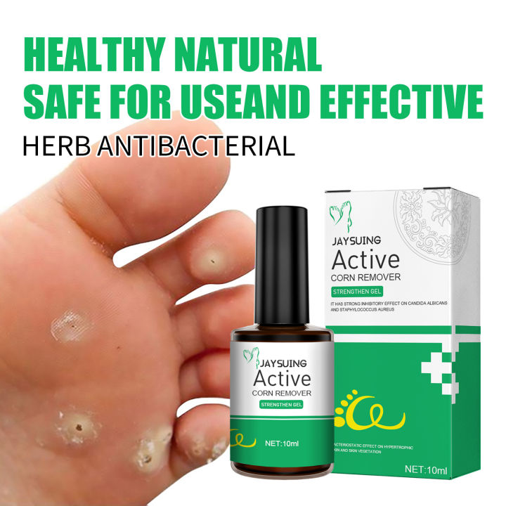 Effectively Remove Foot Corn Care Cream Remove Foot Calluses and Warts ...