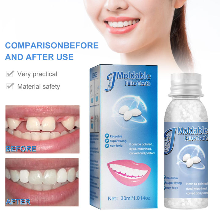 Tooth Repair Granules Temporary Tooth Repair Kit Fitting Beads Reusable ... Tooth Repair Granules Temporary Tooth Repair Kit Fitting Beads Reusable ...