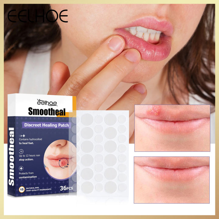 Eelhoe Smootheal Discreet Healing Patch Lip Care Patch Angular ...