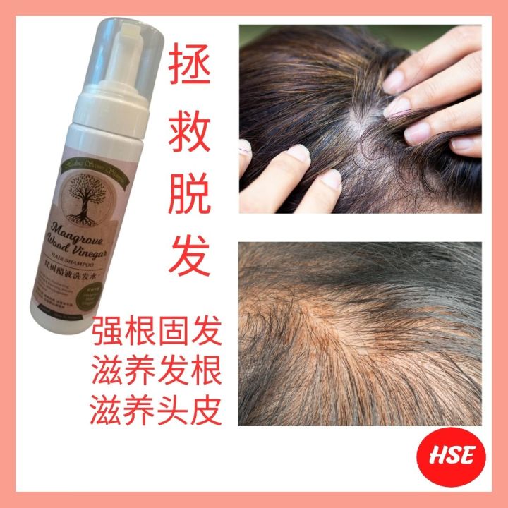 Hair Shampoo Mangrove Wood Vinegar (Organic) 红树醋液洗发水/Shampoo Rambut ...