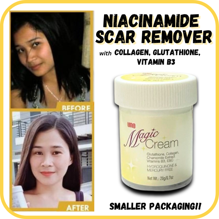 UNO MAGIC CREAM Niacinamide Scar Remover 20g pampakinis ng mukha at ...