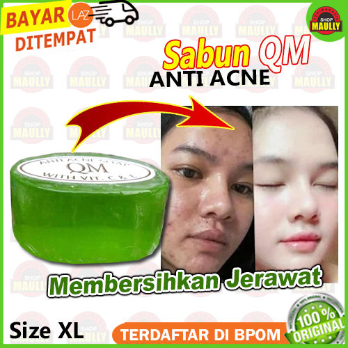 Sabun QM anti Acne Membersihkan Jerawat Secara Cepat Bisa COD | Lazada ...