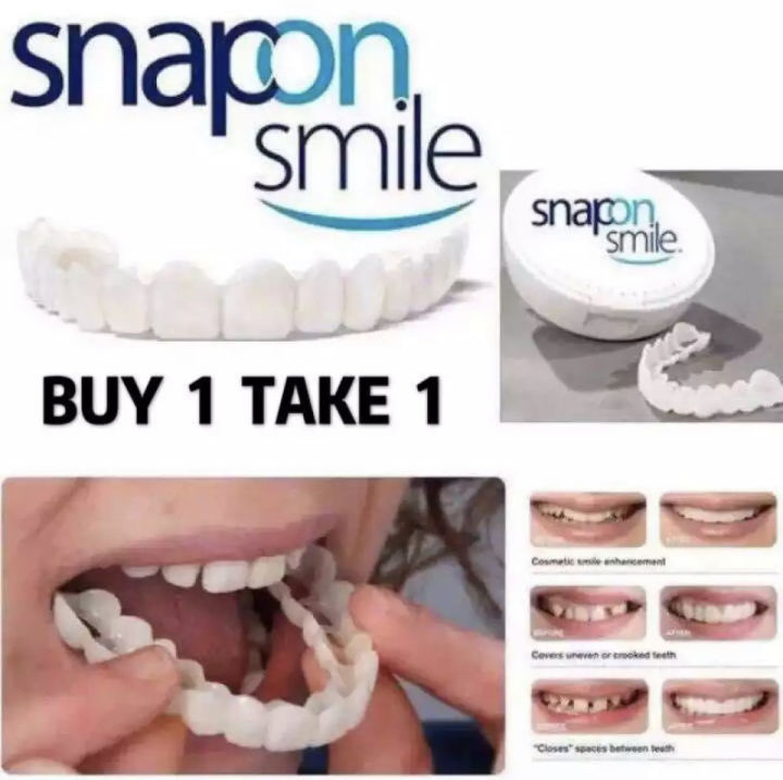 ( BUY 1 TAKE 1 ) Snap On Smile Teeth One Size Fits Snapon Snap-on Smile ...