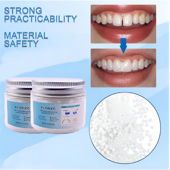 50ML Fast filling Tooth Repair Kit Teeth and Gaps Moldable Falseteeth ...