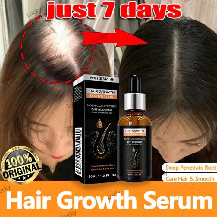 Hair Growth Essence Fast Hair Grower Anti hair loss Scalp treatment ...