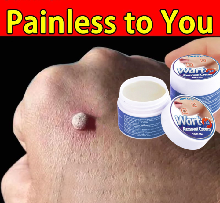 Wart Removal Cream Fast Remove Skin Tag Remover Original Ointment ...