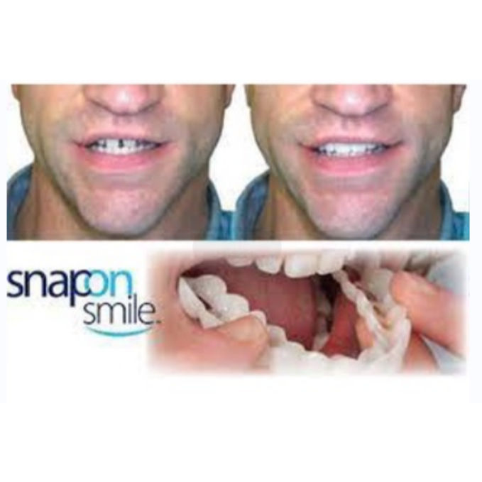 D8teeth fake teeth tooth pustiso teeth ngipin pustiso teeth original ...