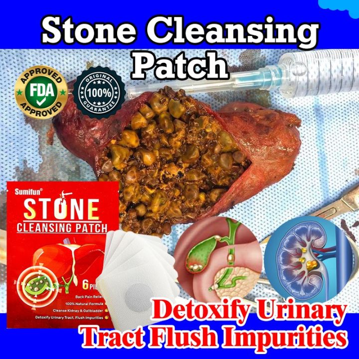 【Effective within7Days】Kidney Stone Removal Breaker Patch Kidney Care ...