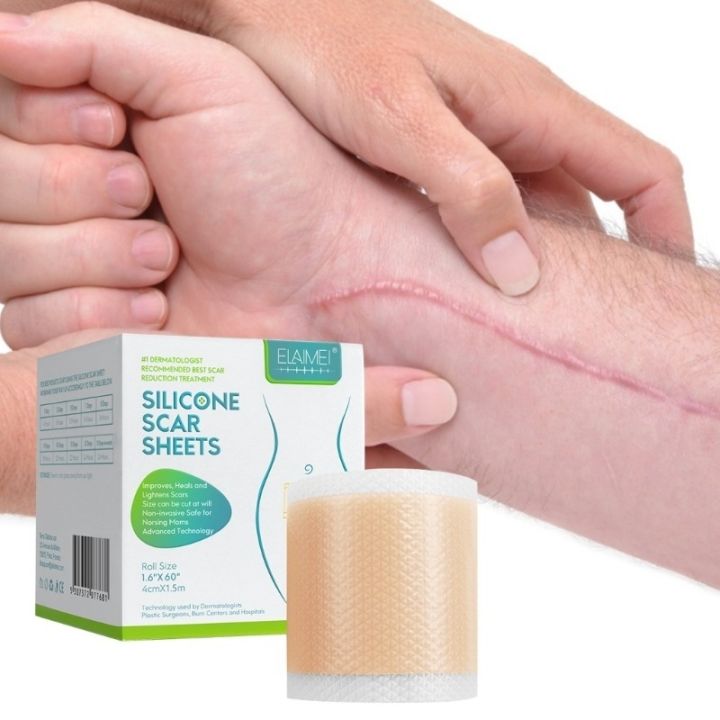 ELAIMEI Silicone Scar Sheets Keloid Plester Penghilang Bekas Luka ...