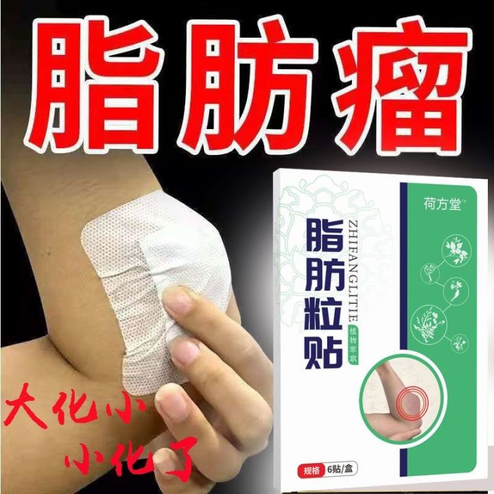 Lipoma bane lipoma post in addition to the cream to eliminate ...