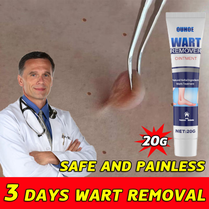💖Safe Painless💖Wart Removal Ointment 20g Wart Remover Cream Wart ...