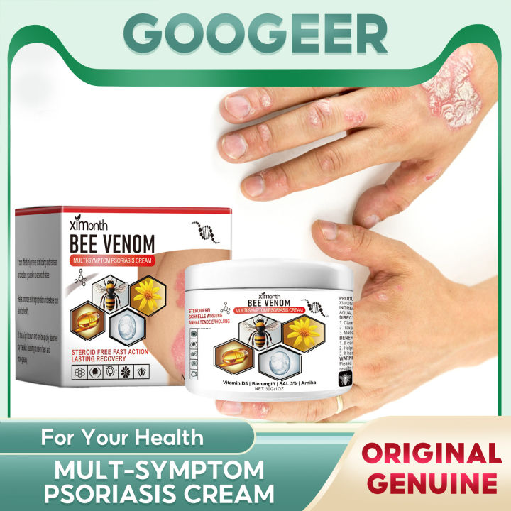Ximonth Bee Venom Psoriasis Cream Treatment Eczema Dermatitis ...