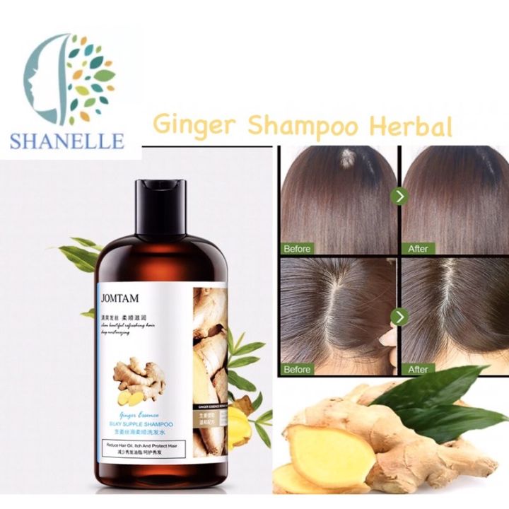 Ginger Shampoo Herbal Anti alopecia, Anti itching, Anti dandruff, Oil Control Shampoo 400ML Anti ...