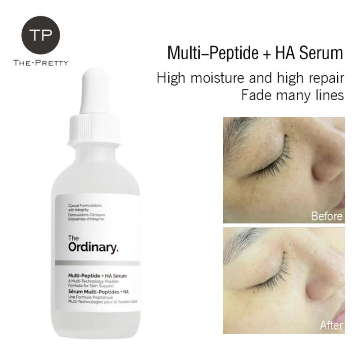The Ordinary - Multi Peptide + HA Serum - 30ml Gift/Present | Lazada ...