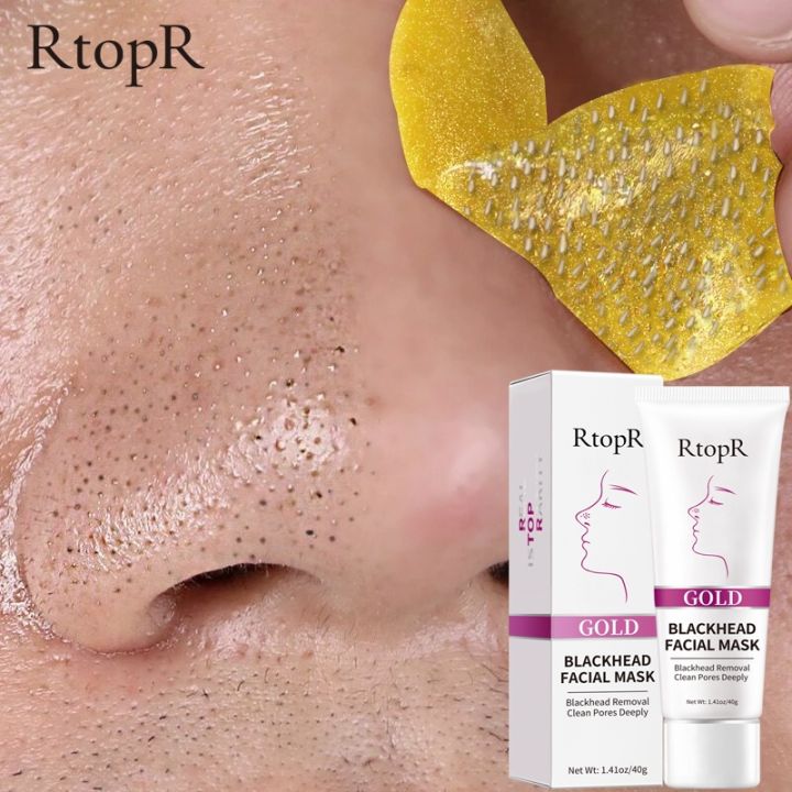 RtopR FDA black head มาสก์โคลน ทําความสะอาดผิวหน้า กำจัดสิวหัวดำ 40 ...