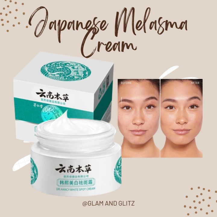 Japanese Melasma Cream | Original High Moisturizing Blemish Cream ...