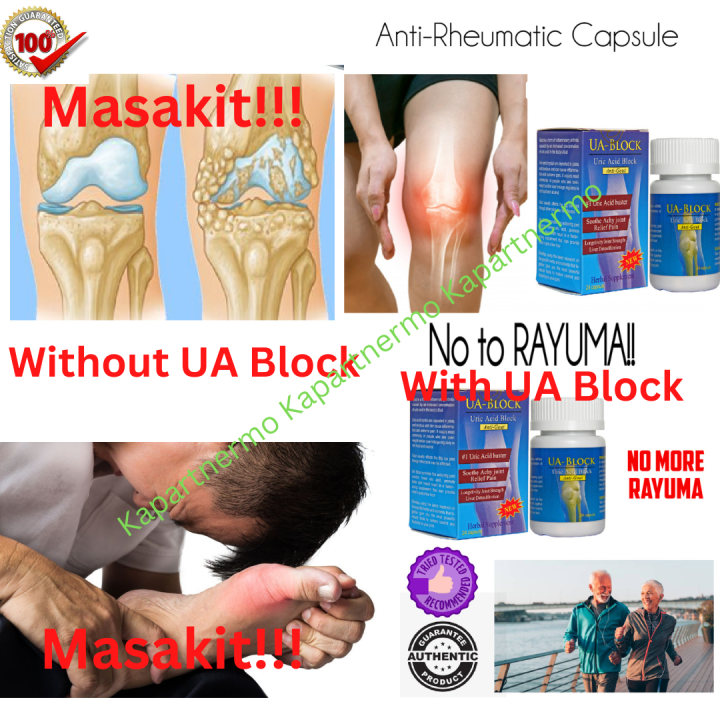 UA-Block Uric Acid Block Anti Gout capsules Arthritis capsule | rayuma ...