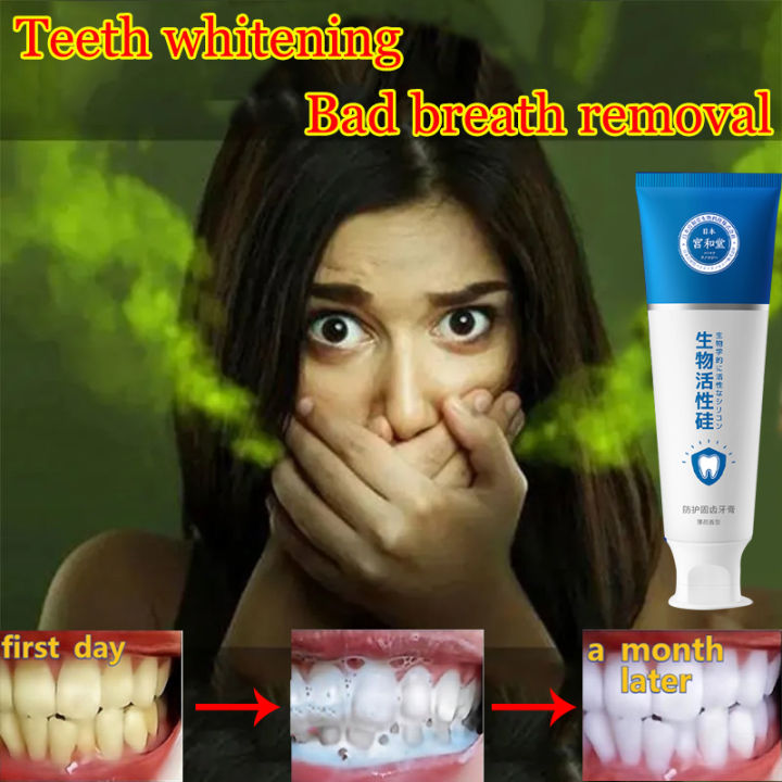 Hot in Japan Toothpaste Teeth Whitening Yellow Teeth Whiten Teeth ...