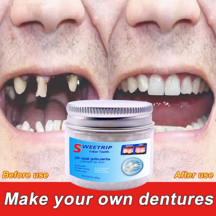 DIY Tooth Repair Kit Temporary Tooth Repair kit 50g Artificial ... DIY Tooth Repair Kit Temporary Tooth Repair kit 50g Artificial ...