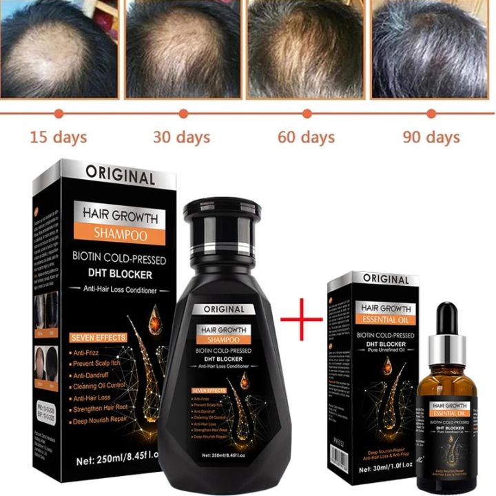 【Hot demand】 Hair Growth Essential Biotin Cold-Pressed Dht Blocker And Hair Growth Shampoo Anti ...