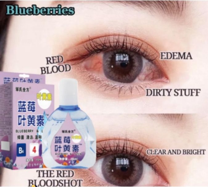 Blueberry Eye Drops From Japan For Dry Eyes Itchy Relieves Red Eyes ...