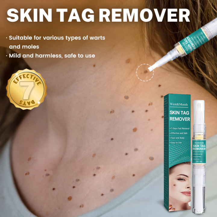 COD Warts Remover Original Skin Wart Removal Cream 20g Kulugo Skin Tags ...