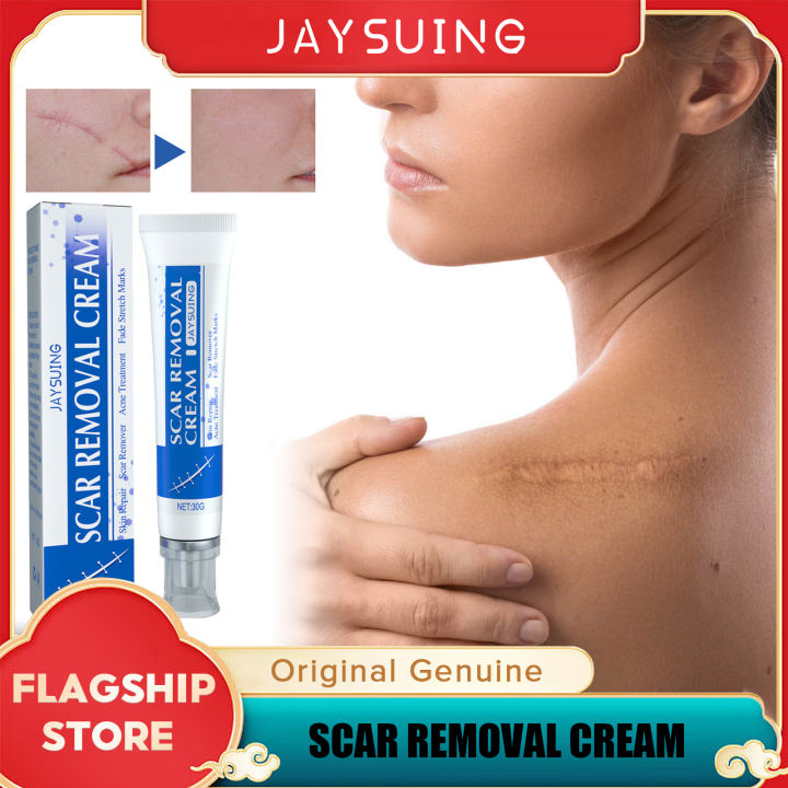 Jaysuing Scar Removal Cream Gel Remove Acne Spots Treatment Stretch Marks Burn Surgical Scar ...