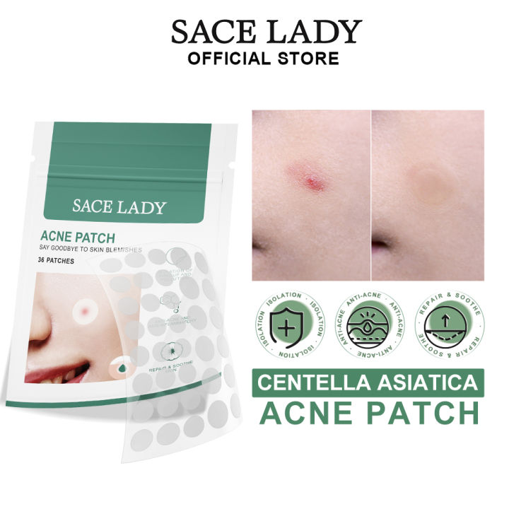 SACE LADY Acne Patch Repair Pimple Marks Repair & Soothe Skin Anti-acne ...