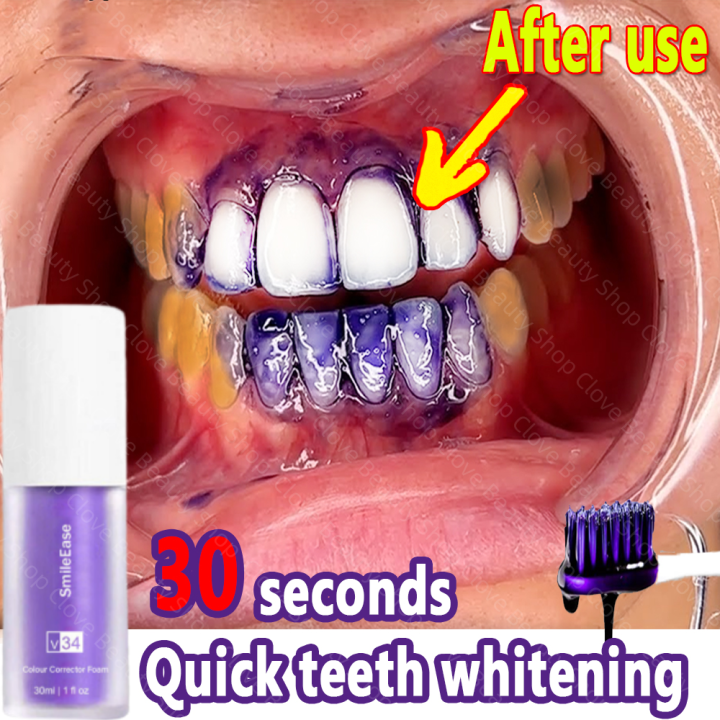 Smile Ease TOOTHPASTE V34 Teeth Whitening Toothpaste Colour Corrector ...