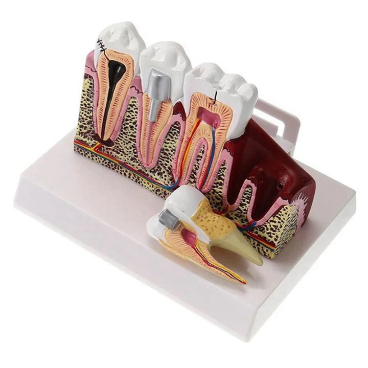 Standard Dental Oral Teeth Anatomical Teaching Model Comprehensive ...