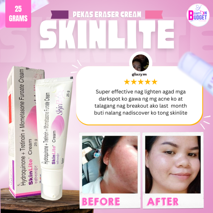 BEWARE OF FAKE! ORIGINAL SKINLITE Cream Melasma Remover TUBE 25g ...