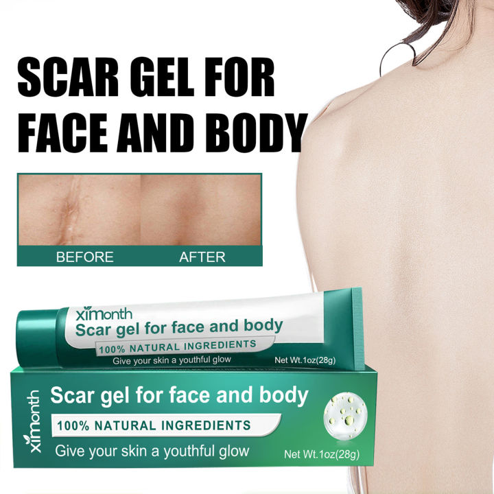 Ximonth Scar Gel 28g Fast Remove Deep Skin Scar Herbal Smooth Whiten Face Skin Care Sooth Skin ...