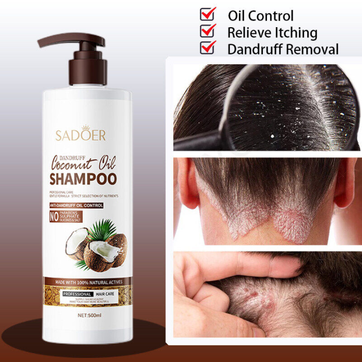 500ml SADOER Coconut Oil Anti Dandruff Shampoo Moisturizing Refreshing Oil Control Shampoo ...