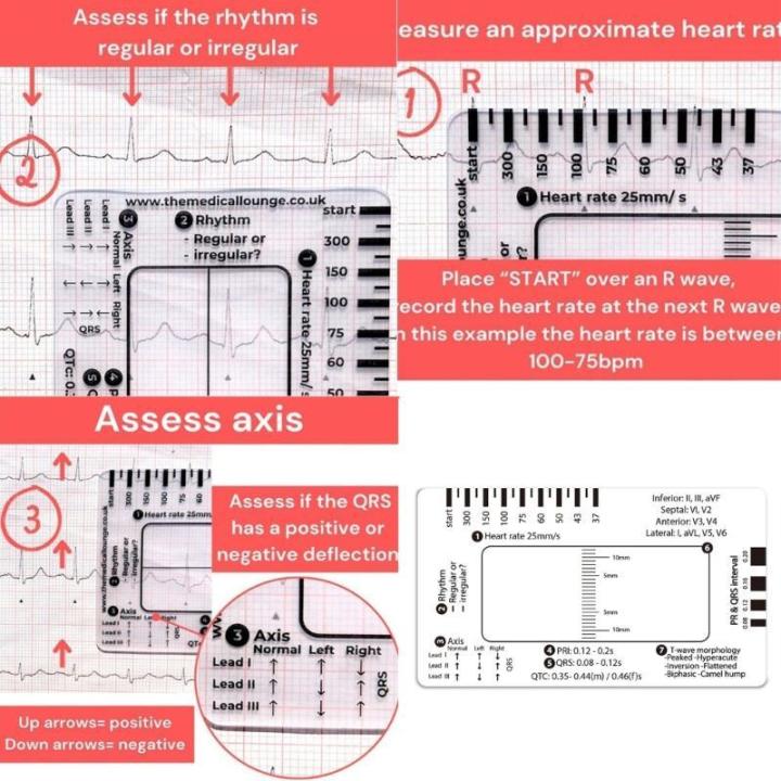 EKG Interpretation Guide Card Convenient EKG Assessment Tool | Lazada