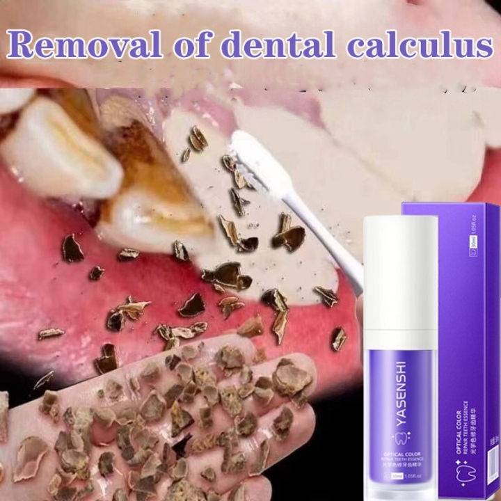 Whitening and de-yellowing removing tooth stains bright white V34 ...