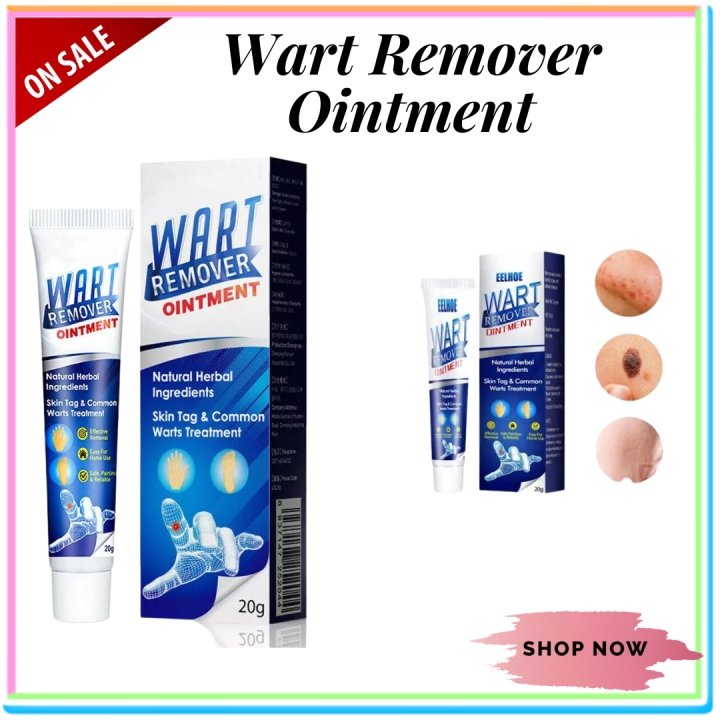 WART REMOVAL Warts Remover Original Cream Warts Magic Remover Wartz ...